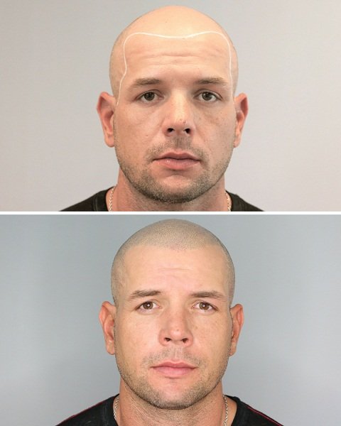 HAIRLINE INK - 6454 N New Braunfels Ave, San Antonio, Texas - Hair Loss ...