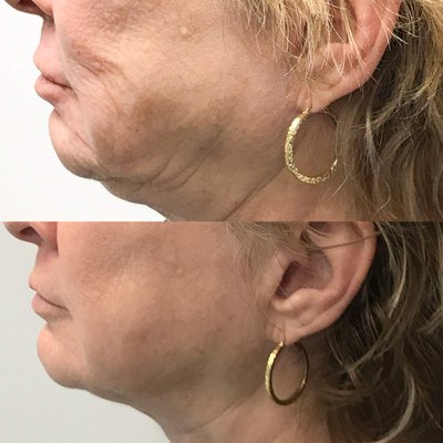 CONTOUR DERMATOLOGY & COSMETIC SURGERY CENTER - 38 Photos & 107 Reviews ...
