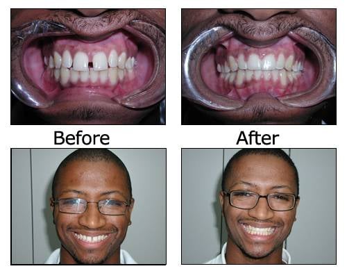 BIG SMILE DENTAL - Updated December 2025 - 27 Photos & 74 Reviews ...