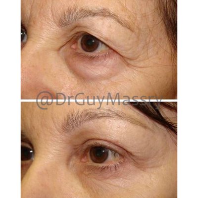 GUY MASSRY, MD - Updated December 2025 - 154 Photos & 176 Reviews - 150 ...