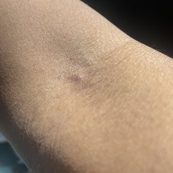 LABCORP - Updated October 2025 - 32 Photos & 90 Reviews - 960 E Green ...