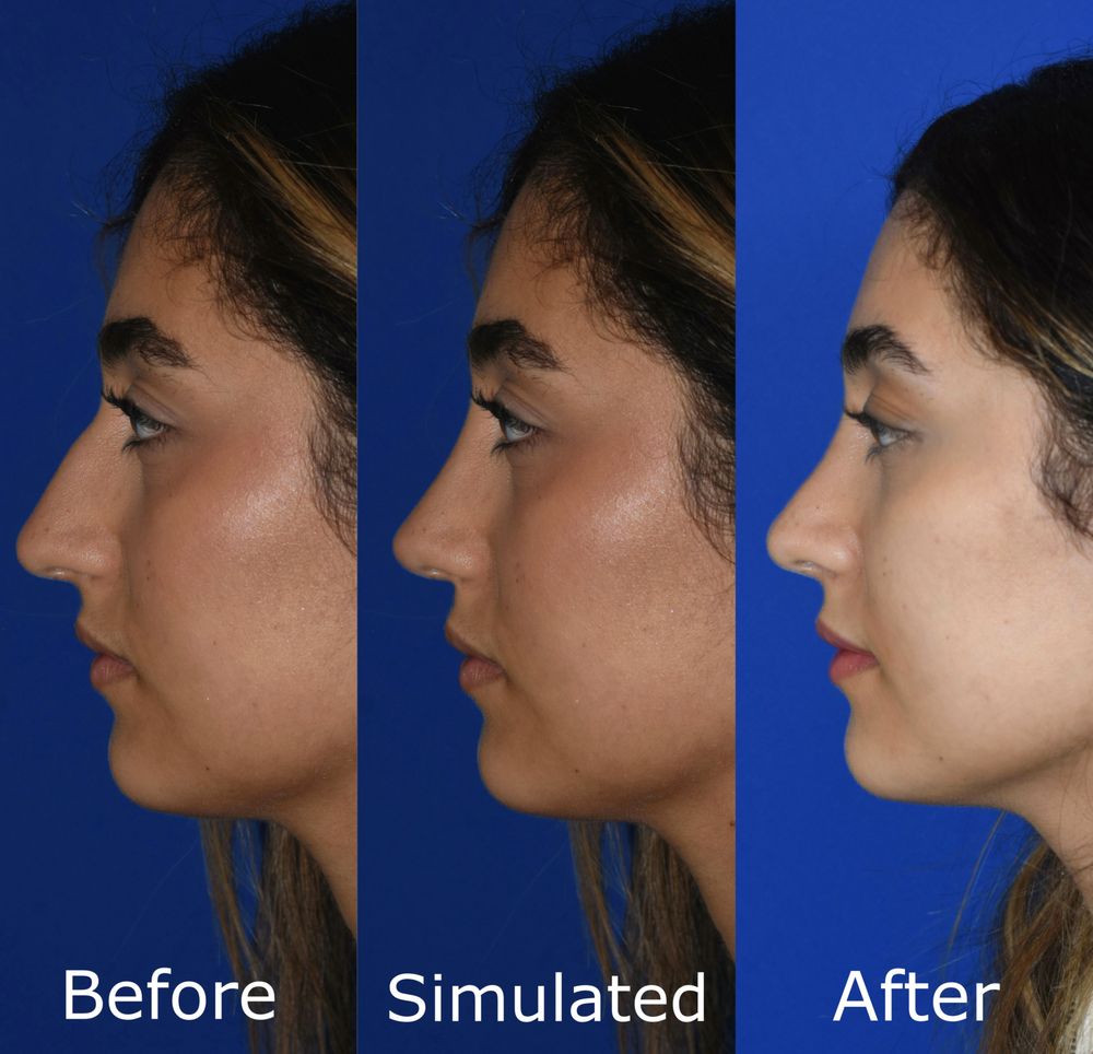 THE SEATTLE FACIAL PLASTIC SURGERY CENTER - Updated January 2026 - 52 ...