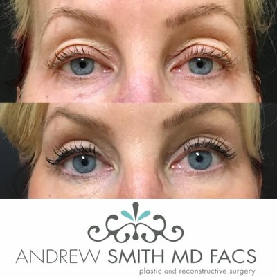 ANDREW SMITH, MD, FACS - Updated January 2026 - 87 Photos & 117 Reviews ...