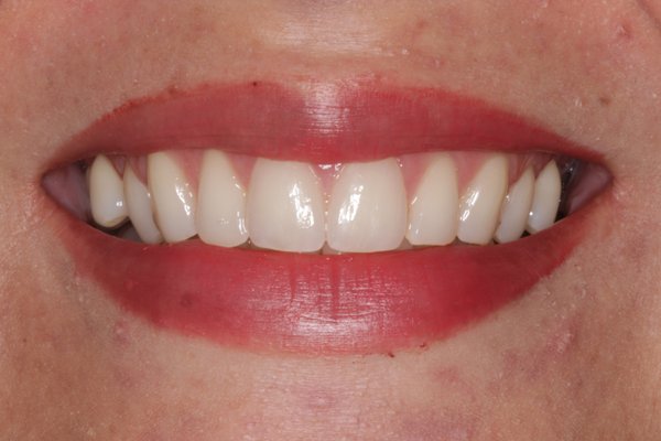 RYAN CANDELORA, DDS & CHARLES KIM, DDS - GLENDALE DENTIST - Updated ...