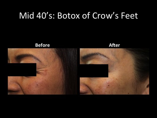 LAFACE BY LAURA PHAN, MD - Updated January 2026 - 35 Photos & 64 ...