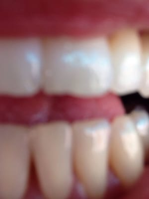 FRANK TARANTINO, DDS, PC - Updated May 2026 - 17 Photos & 54 Reviews ...