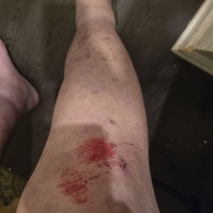 TENNESSEE ORTHOPAEDIC ALLIANCE TOA - HENDERSONVILLE - Updated August ...