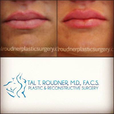 TAL T. ROUDNER, MD, FACS - Updated December 2024 - 40 Photos & 33 ...