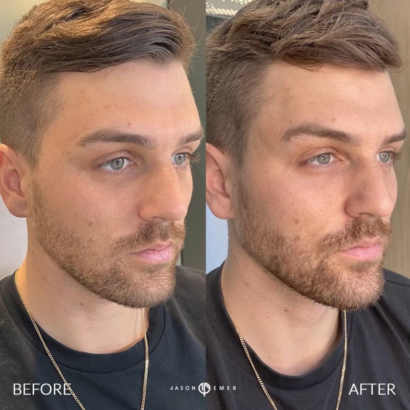 JASON EMER, MD - Updated July 2024 - 1041 Photos & 464 Reviews - 9201 ...