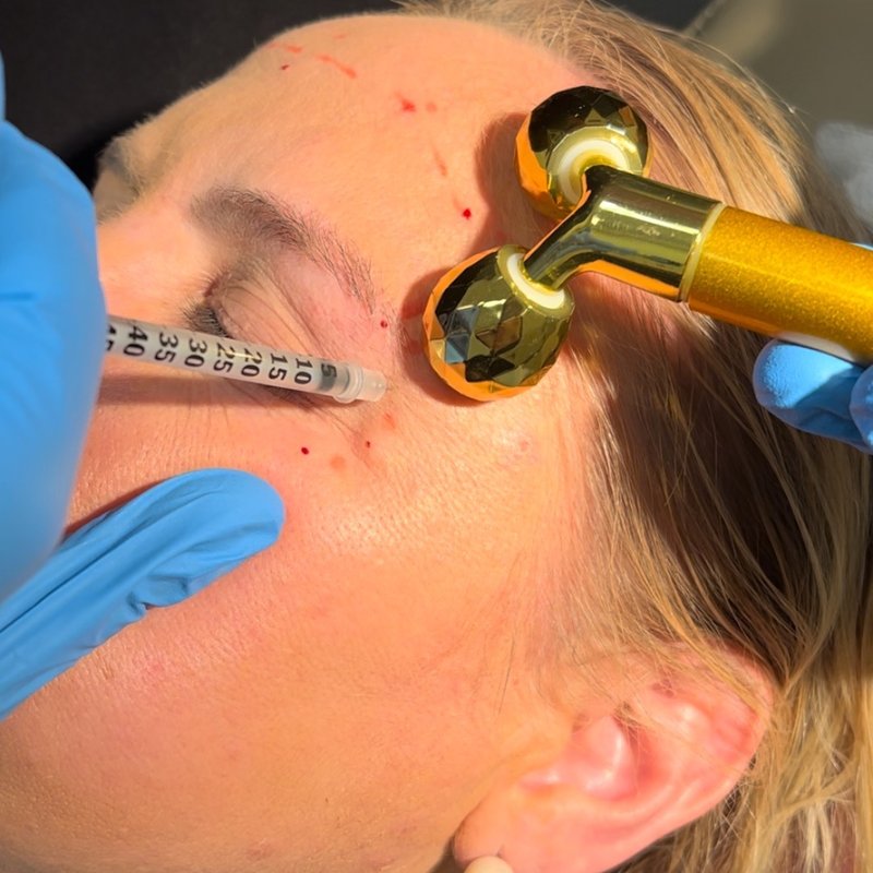 SKIN WORKS MEDICAL SPA - Updated June 2024 - 163 Photos & 379 Reviews ...