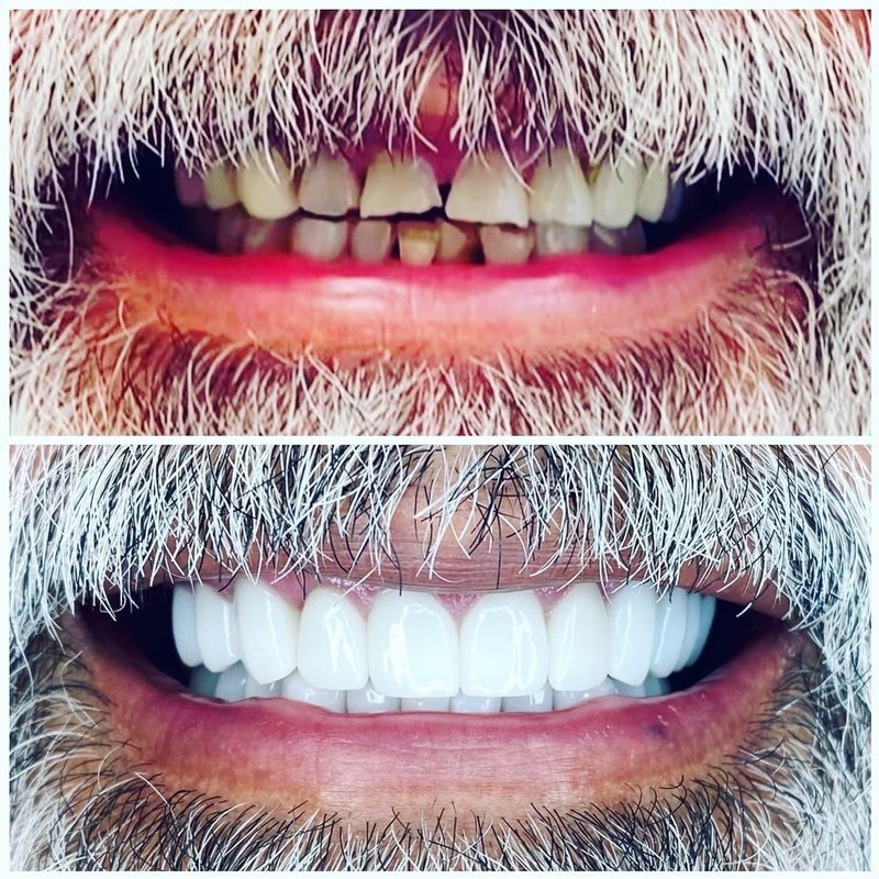 SIGNATURE SMILES DENTAL - Updated May 2026 - 83 Photos & 128 Reviews ...