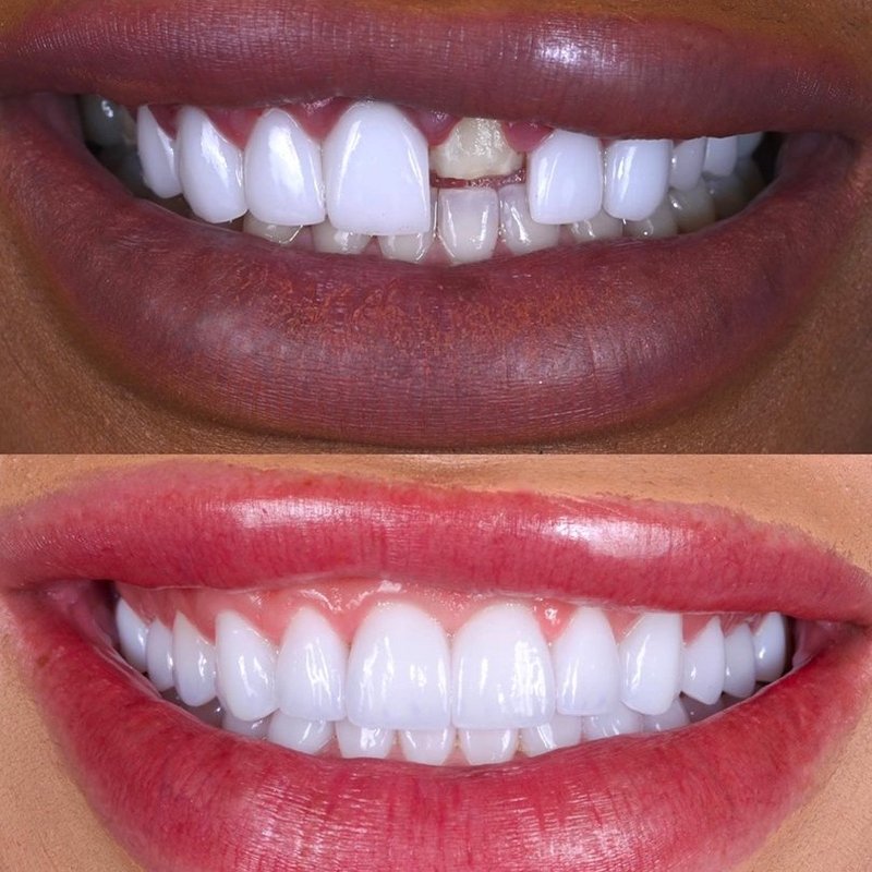 JEREMY HELDT, DDS - Updated June 2024 - 224 Photos & 98 Reviews - 2001 ...