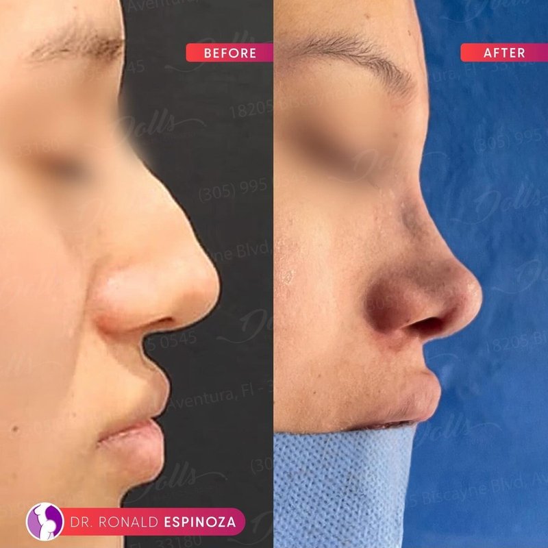 DOLLS PLASTIC SURGERY - Updated December 2025 - 51 Photos & 43 Reviews - 18205 Biscayne Blvd ...