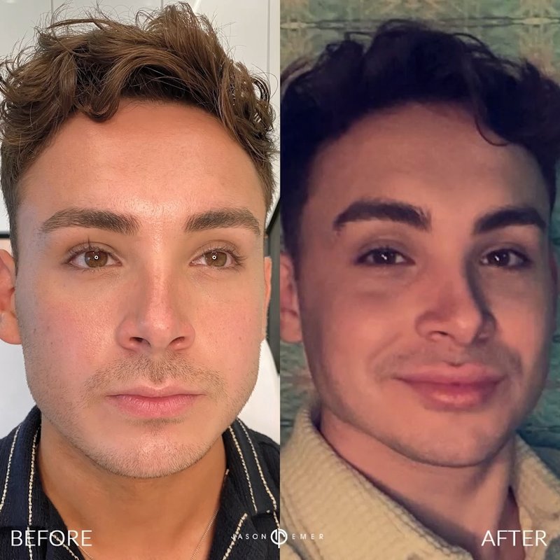 JASON EMER, MD - Updated July 2024 - 1041 Photos & 464 Reviews - 9201 ...