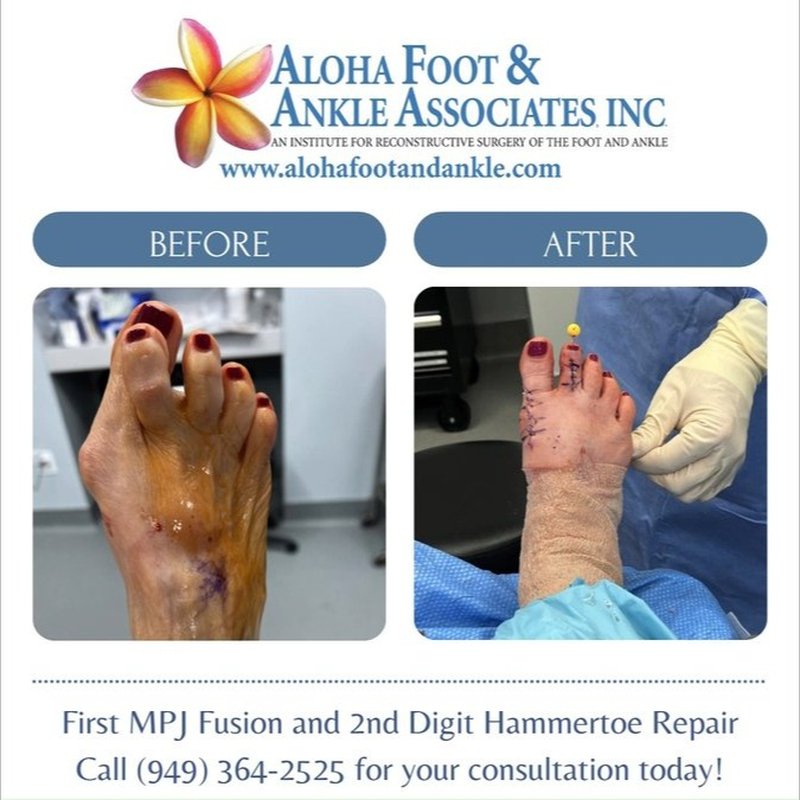 ALOHA FOOT AND ANKLE ASSOCIATES - Updated December 2025 - 39 Photos ...