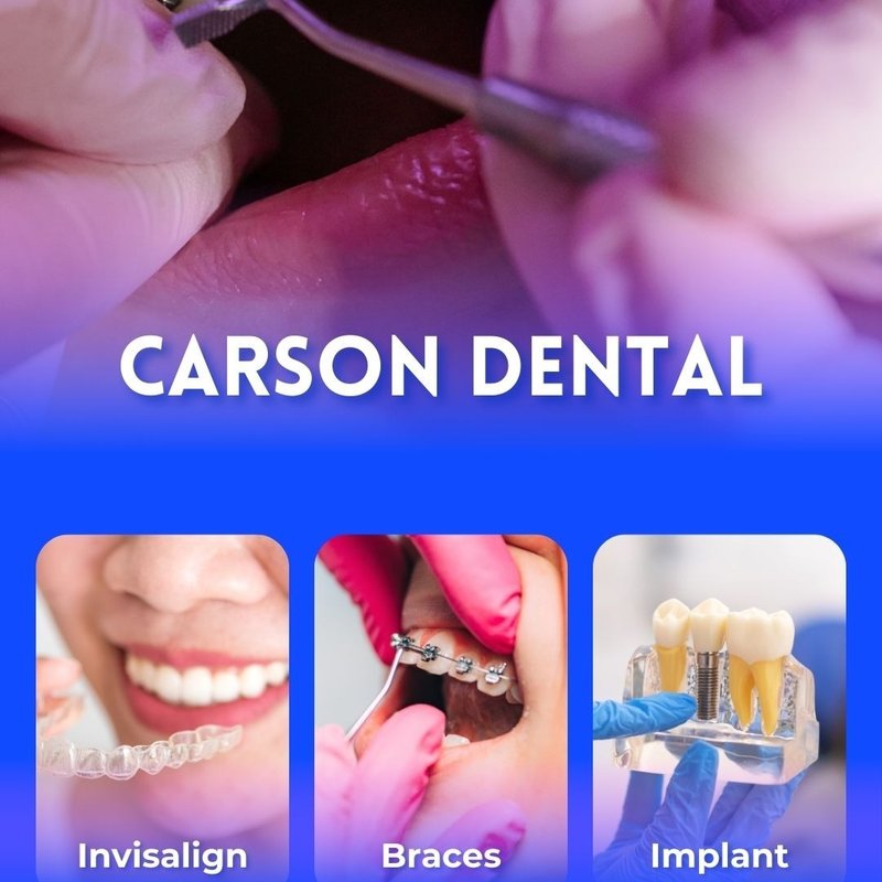 CARSON DENTAL - Updated August 2024 - 104 Photos & 161 Reviews - 23535 ...