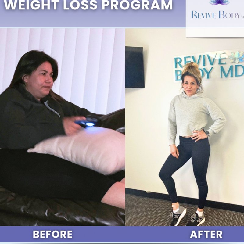 REVIVE BODY MD - Updated January 2026 - 93 Photos & 58 Reviews - 636 E ...