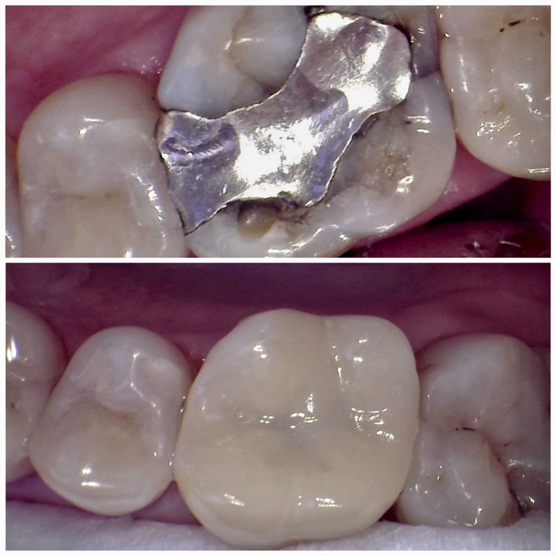 GLEN DENTAL STUDIO: STEPAN HARUTYUNYAN, DMD - Updated December 2025 ...