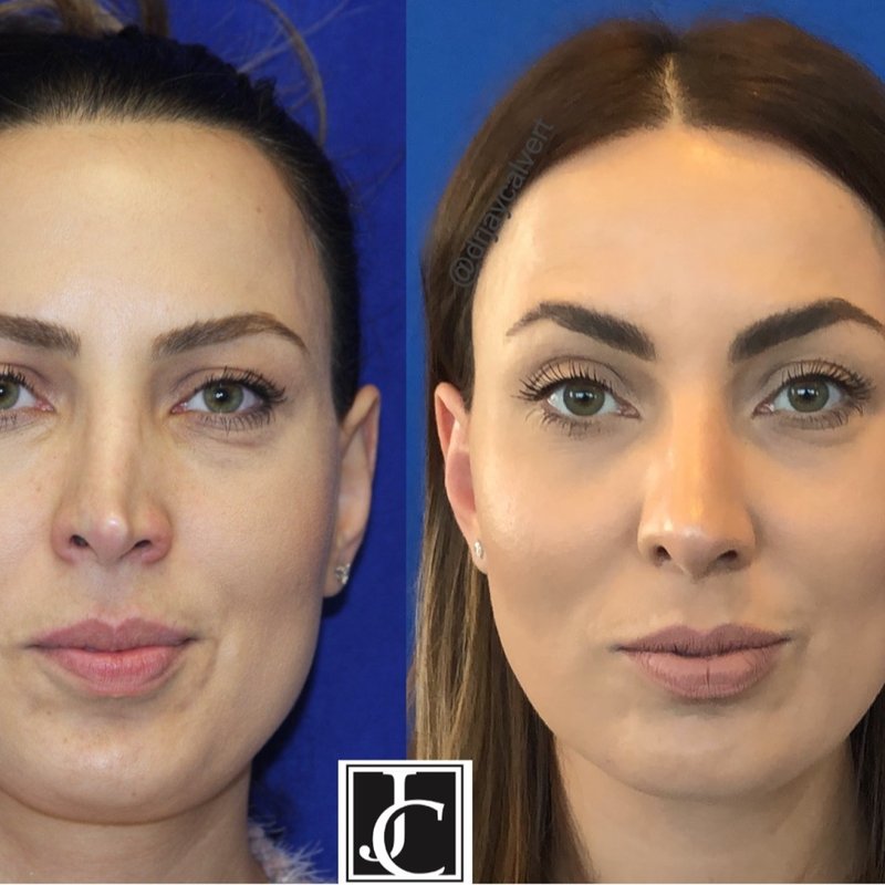 DR JAY CALVERT PLASTIC SURGERY - Updated December 2025 - 39 Photos & 34 ...