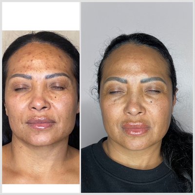 AUBRIE COOK AESTHETICS - Updated October 2025 - 75 Photos & 52 Reviews ...