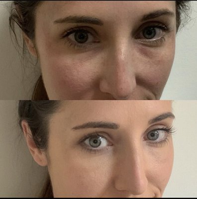 BOTOX SISTERS- LAURA HERTZOG, NP & REBECCA CEVERHA, NP - Updated ...