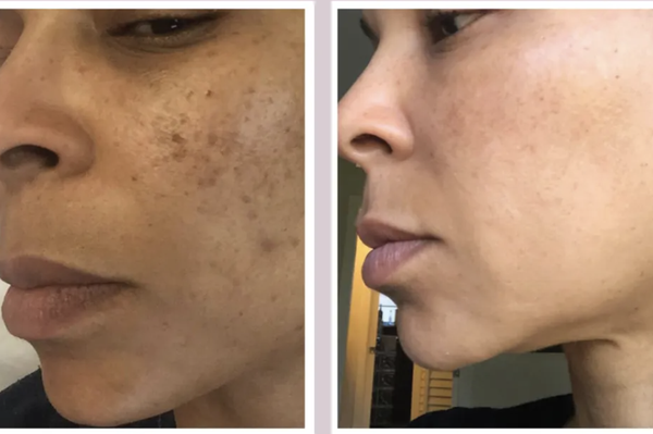 SKIN FIX FACIAL BAR - Updated July 2025 - 25 Photos - 1437 10th St, St ...