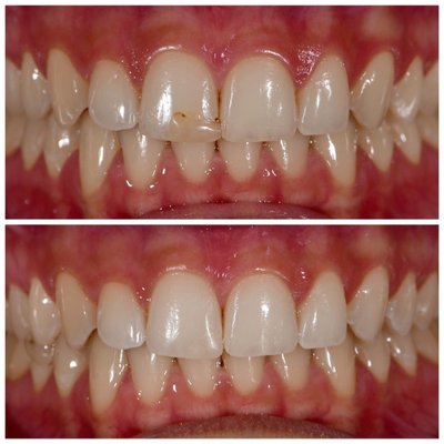 FULLER SMILES - NORTHRIDGE - Updated January 2026 - 87 Photos & 371 ...