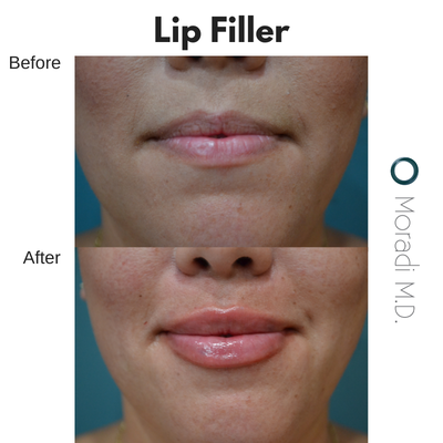 MORADI MD - Updated October 2025 - 35 Photos & 18 Reviews - 300 ...