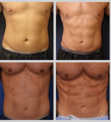 DR REFRESH - Updated September 2025 - 70 Photos & 148 Reviews - 1106 N ...