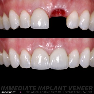 JEREMY HELDT, DDS - 227 Photos & 93 Reviews - 2001 Westcliff Dr ...