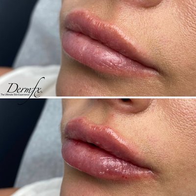 DERMFX - Updated September 2025 - 148 Photos & 278 Reviews - 1870 S ...