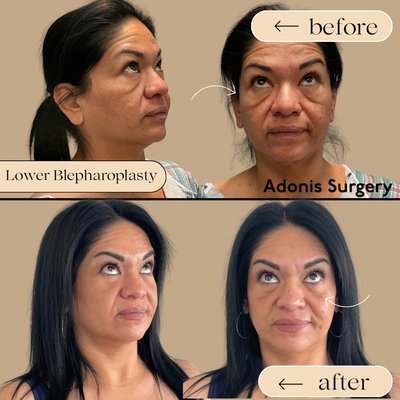 ADONIS PLASTIC SURGERY - Updated January 2025 - 44 Photos & 19 Reviews - 2557 Pacific Coast Hwy ...