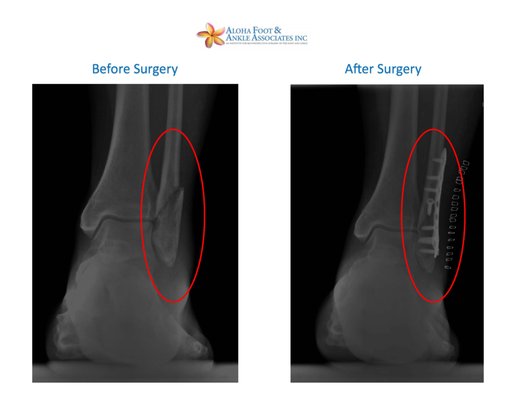 ALOHA FOOT AND ANKLE ASSOCIATES - Updated June 2025 - 38 Photos & 84 ...
