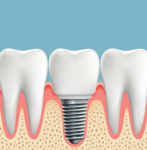 SHOW YOUR GRIN DENTAL - Updated September 2025 - 24 Photos & 28 Reviews ...