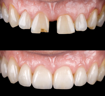 FULLER SMILES - NORTHRIDGE - Updated January 2026 - 87 Photos & 371 ...