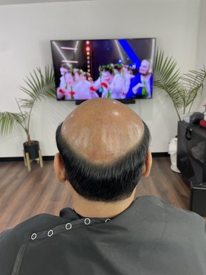 UNIVERSAL HAIR UNITS - Updated September 2025 - Request an Appointment ...