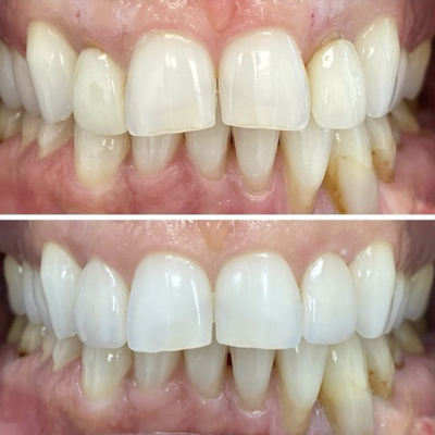 FULLER SMILES - LONG BEACH - Updated December 2025 - 51 Photos & 119 ...