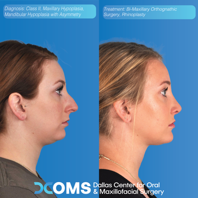DALLAS CENTER FOR ORAL & MAXILLOFACIAL SURGERY - Updated May 2026 - 38 ...