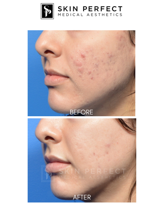 SKIN PERFECT MEDICAL AESTHETICS - Updated December 2025 - 211 Photos ...