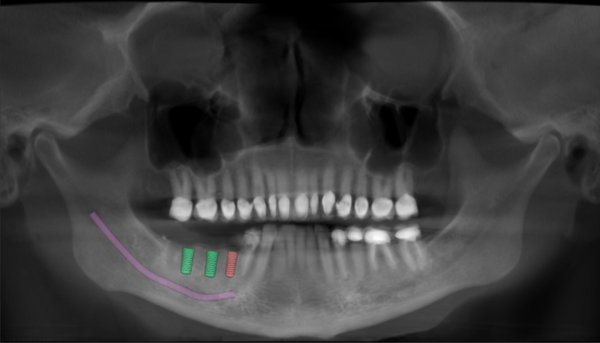 Yorba Linda Oral & Maxillofacial Surgery - Updated May 2026 - 120 ...