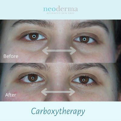 NEODERMA - Updated August 2024 - 449 Photos & 248 Reviews - 1175 E ...