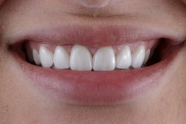 DYNAMIC SMILE DESIGN - Updated April 2025 - 42 Photos & 18 Reviews ...