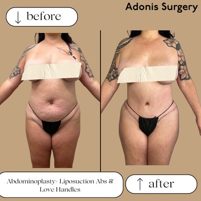 ADONIS PLASTIC SURGERY - Updated August 2024 - 40 Photos & 10 Reviews - 2557 Pacific Coast Hwy ...