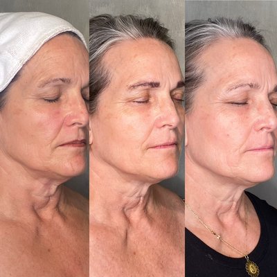 AUBRIE COOK AESTHETICS - Updated October 2025 - 75 Photos & 52 Reviews ...