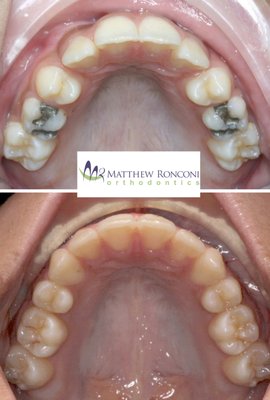 MATTHEW RONCONI ORTHODONTICS - Updated March 2025 - 29 Photos & 19 ...