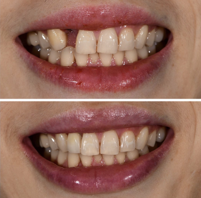 FULLER SMILES - LONG BEACH - Updated December 2025 - 51 Photos & 119 ...