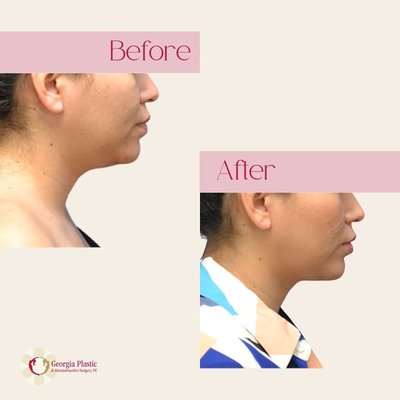 GEORGIA PLASTIC & RECONSTRUCTIVE SURGERY - Updated May 2026 - 93 Photos ...