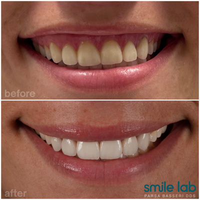SMILE LAB DENTISTRY UNION SQUARE - Updated May 2026 - 41 Photos & 53 ...