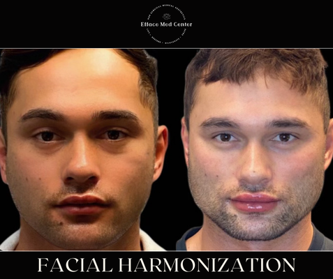 EFFACE MED CENTER - 245 Peachtree Industrial Blvd, Sugar Hill, Georgia ...