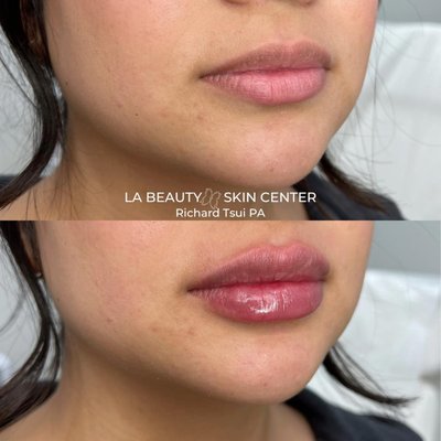 LA BEAUTY SKIN CENTER - Updated August 2024 - 570 Photos & 1015 Reviews ...